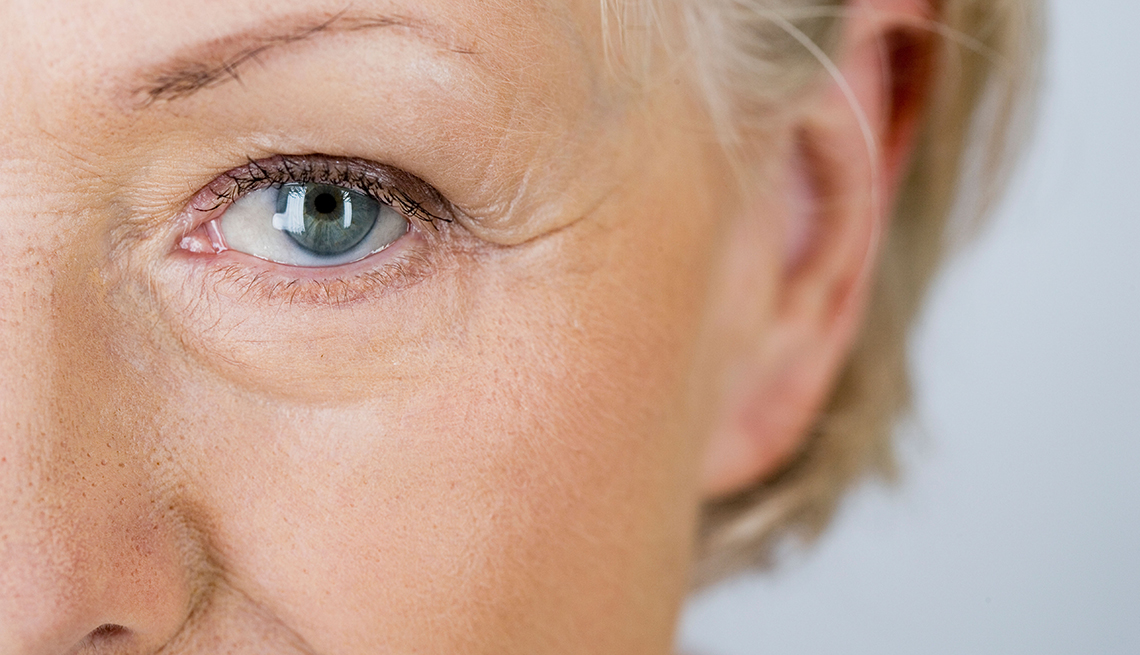 What Causes Age Related Macular Degeneration what-causes-age-related-macular-degeneration