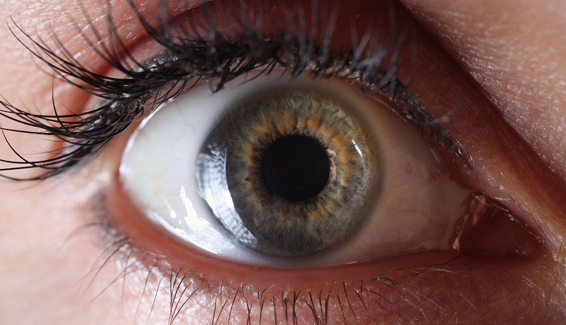 Síntomas del desprendimiento de retina